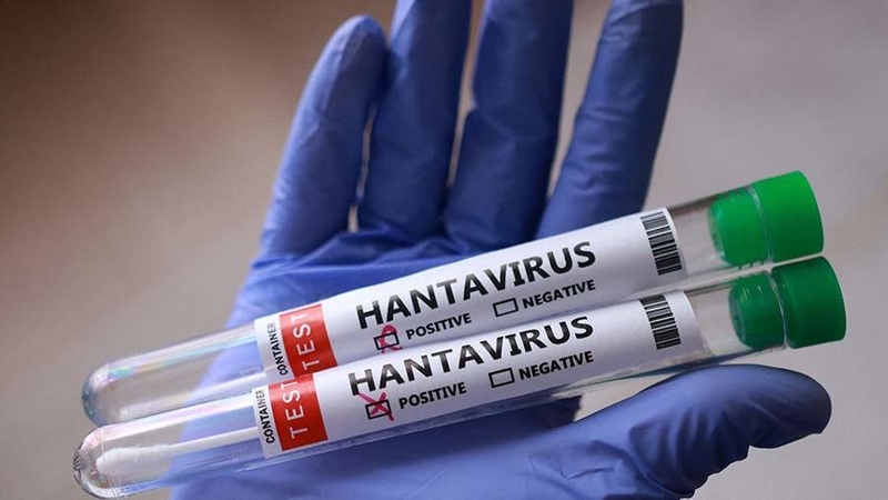 Ministry of Health: Risk of hantavirus importation to Kyrgyzstan is ...